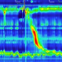 Solar GI HRM | MKS Medic