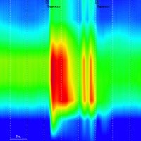 Solar GI HRAM | MKS Medic